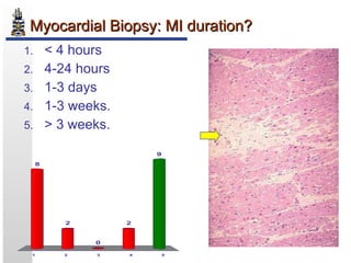 Pathology of Myocardial Infarction | PPT