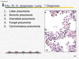 Pathology of Pneumonia | PPTX