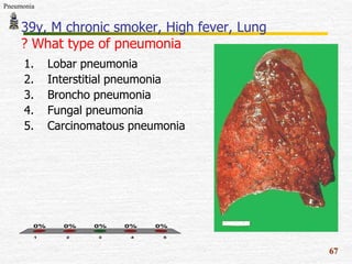 Pathology of Pneumonia | PPTX
