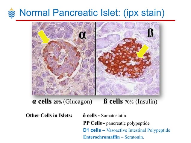 Pathology of Diabetes