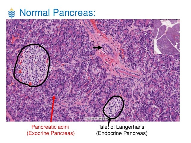 Pathology of Diabetes