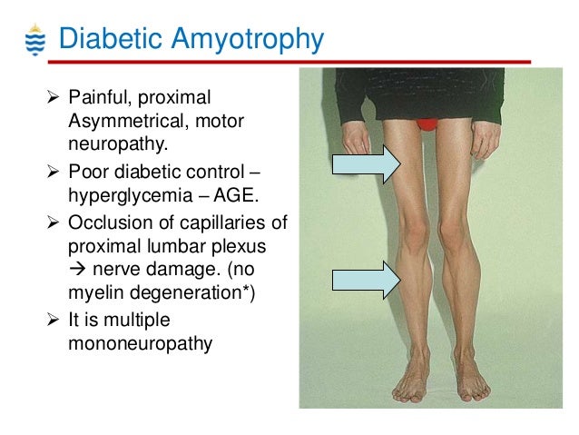 Pathology of Diabetes