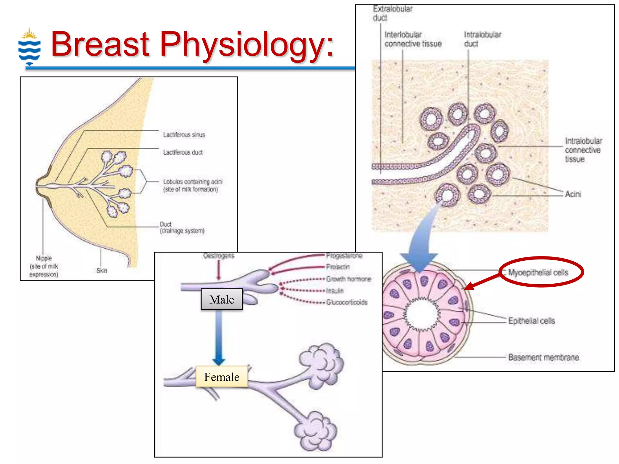 Breast Pathology Lecture - 2013 | PPTX