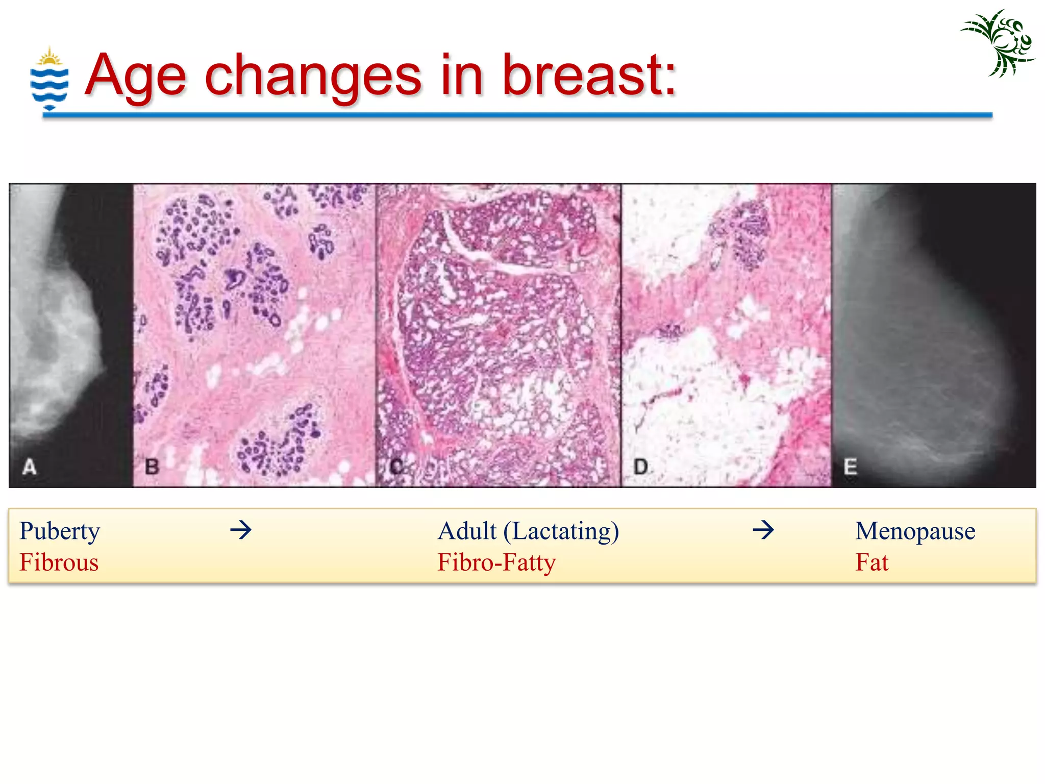 Breast Pathology Lecture - 2013 | PPTX