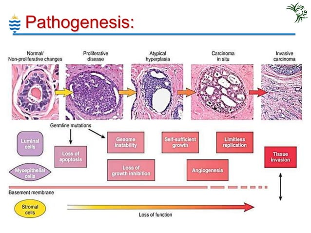 Breast Pathology Lecture - 2013 | PPTX | Cancer | Diseases and Conditions