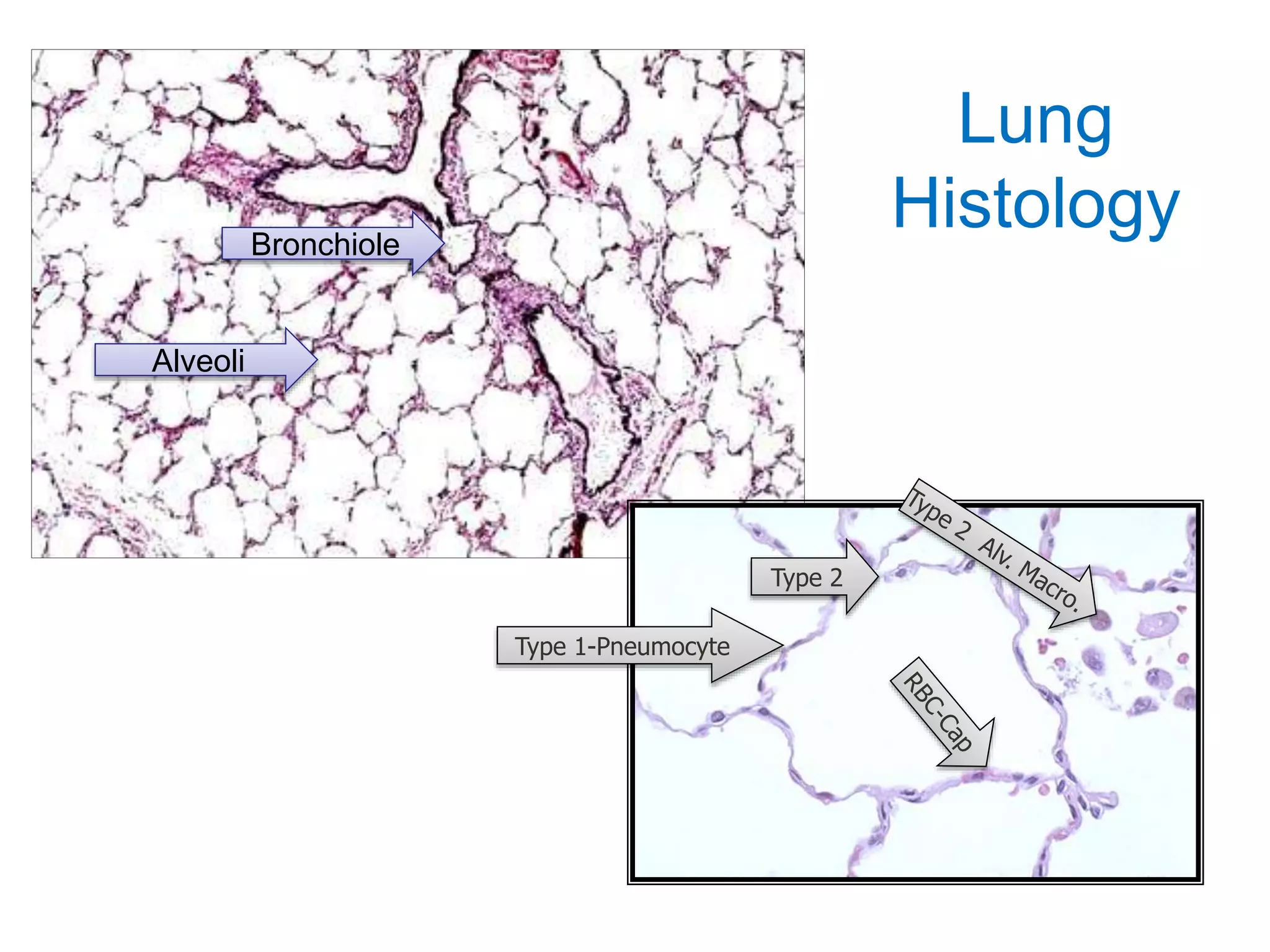 Pathology of COPD | PPTX