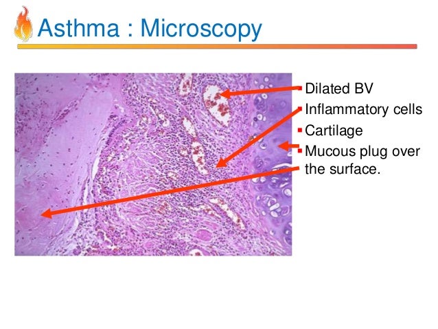Pathology of COPD