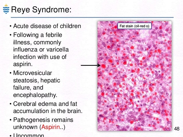 Pathology of Hepatitis - Lecture