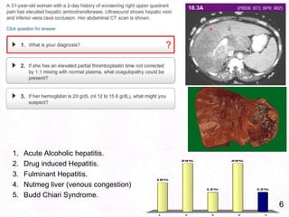 Pathology of Hepatitis - Quiz | PPTX | Blood Disorders | Diseases and Conditions