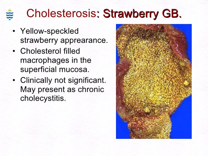 Disorders of Biliary System