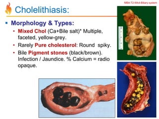 Pathology of Biliary Disorders. | PPTX