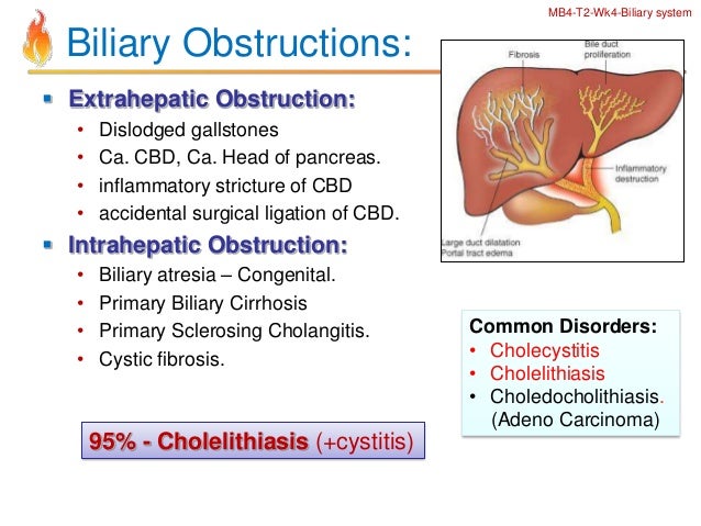 Pathology of Biliary Disorders.