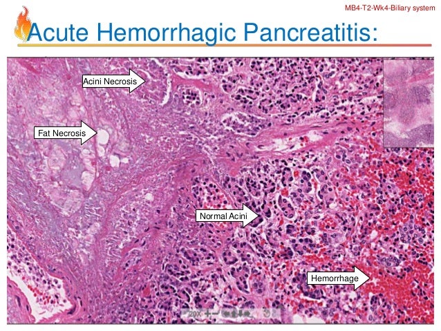 Pathology of Biliary Disorders.