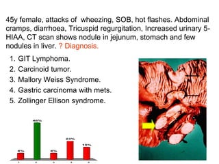 Pathology of Upper GIT - Quiz | PPTX