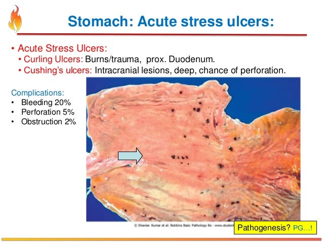Pathology of Upper GIT