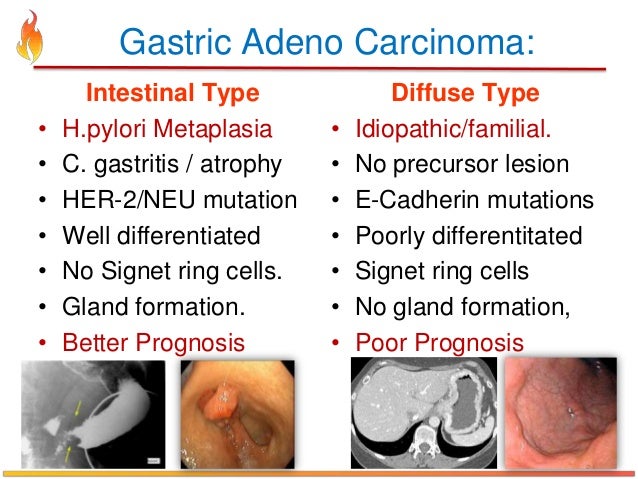 Pathology of Upper GIT