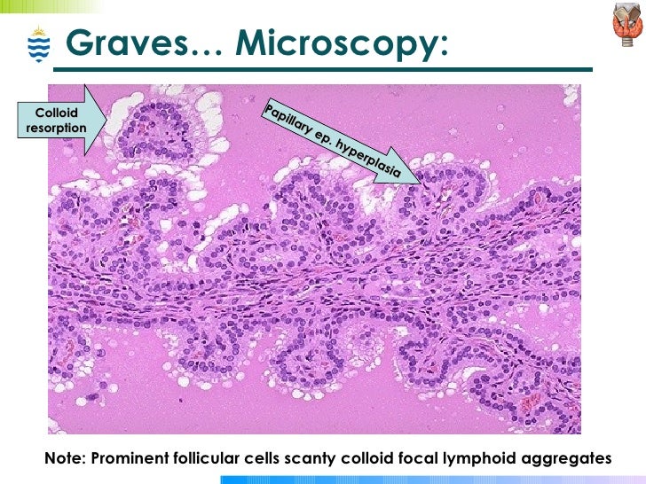 Pathology of Endocrine Disorders
