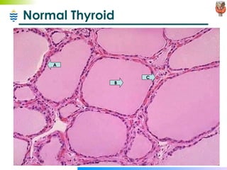Normal Thyroid Histology