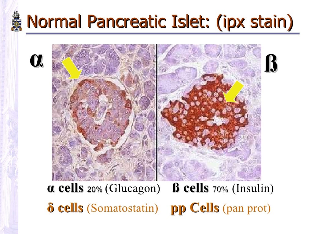 Pathology of Diabetes