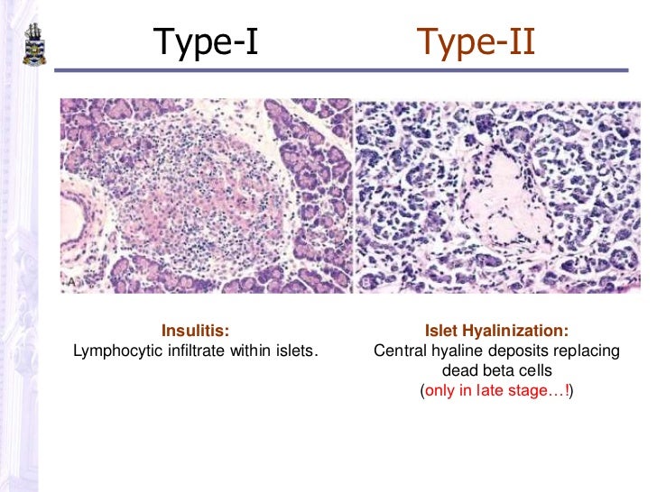 Pathology of Diabetes