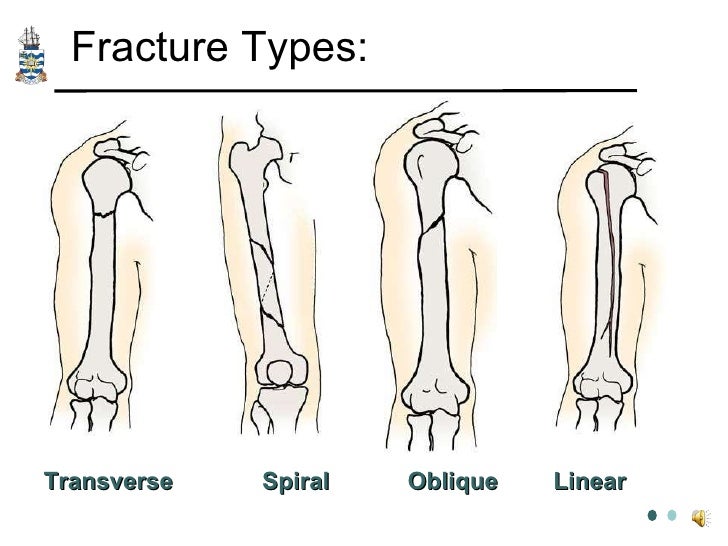 Pathology of Trauma