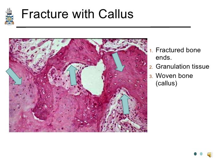 Pathology of Trauma