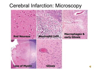 Red Neurons