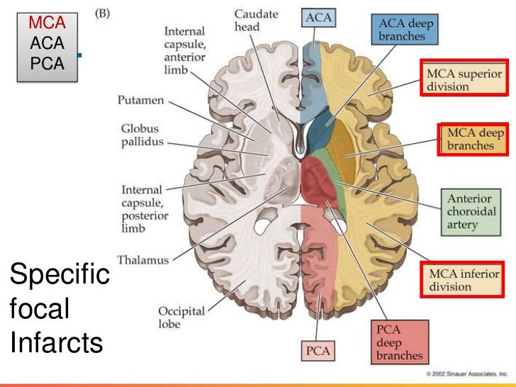 Pathology of Stroke & CVA