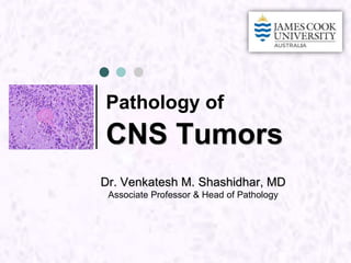 Pathology of CNS Tumors | PPTX