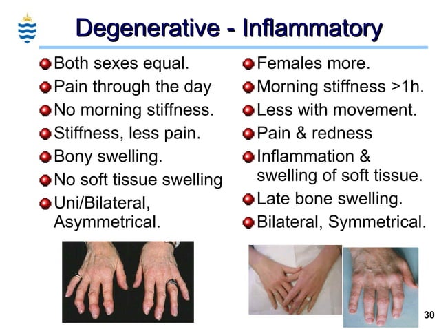 Pathology of Arthritis | PPT