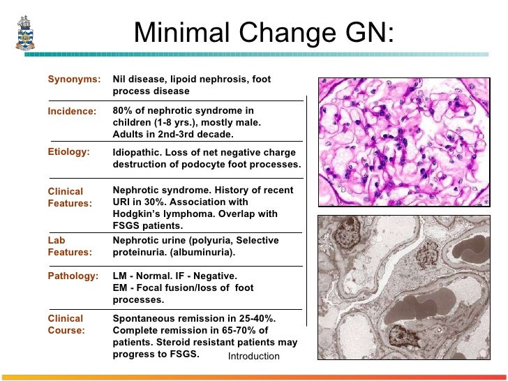 Pathology of Glomerulonephritis