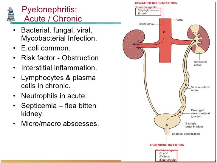 Pathology of Glomerulonephritis