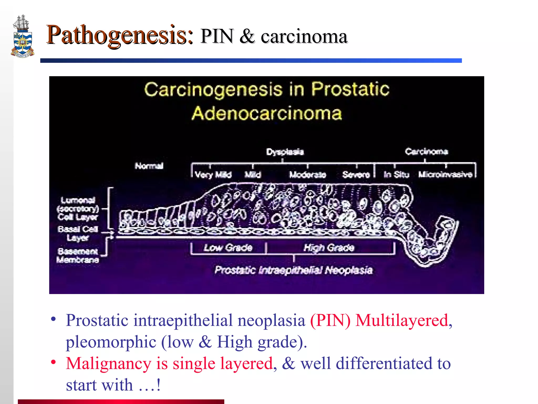 Pathology of Prostate | PPT
