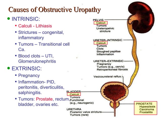 Pathology of Prostate | PPT