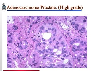 Prostate Histology