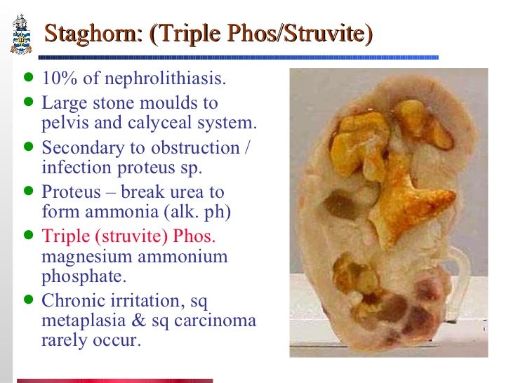Pathology of Prostate