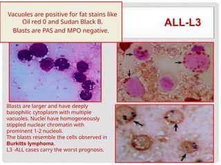 CPC - PEDIATRIC CASE .pptx