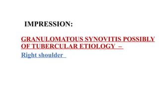 HISTOPATHOLOGY OF GRANULOMATOUS SYNOVITIS | PPTX
