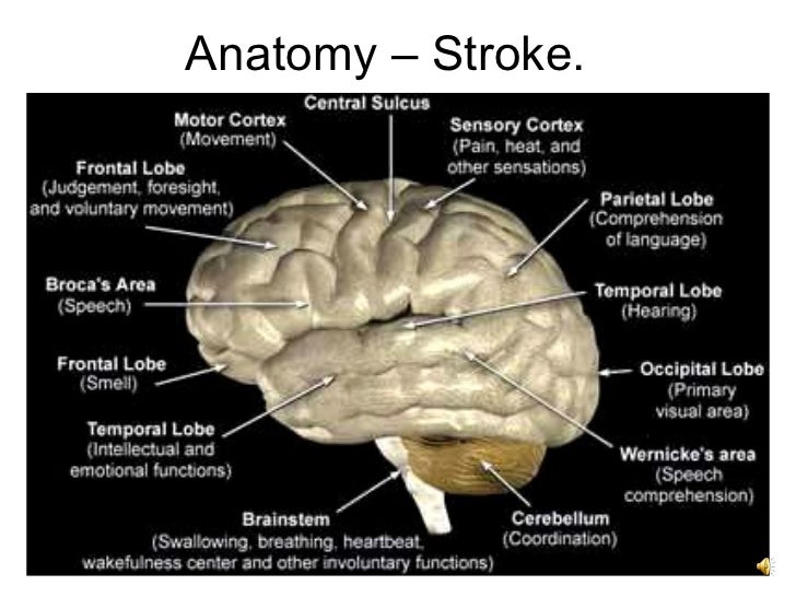 Pathology of Stroke-CVA