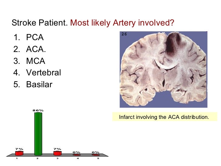 Pathology of Stroke-CVA
