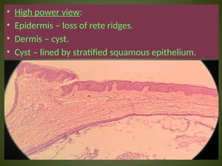 CLINICOPATHCORRELATION MODEL DERMATOLOGY.pptx | Skin and Dermatology ...