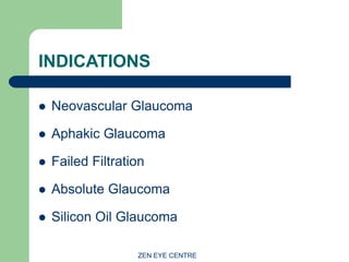 CYCLODIODE LASER FOR GLAUCOMA -AJAY DUDANI | PPT