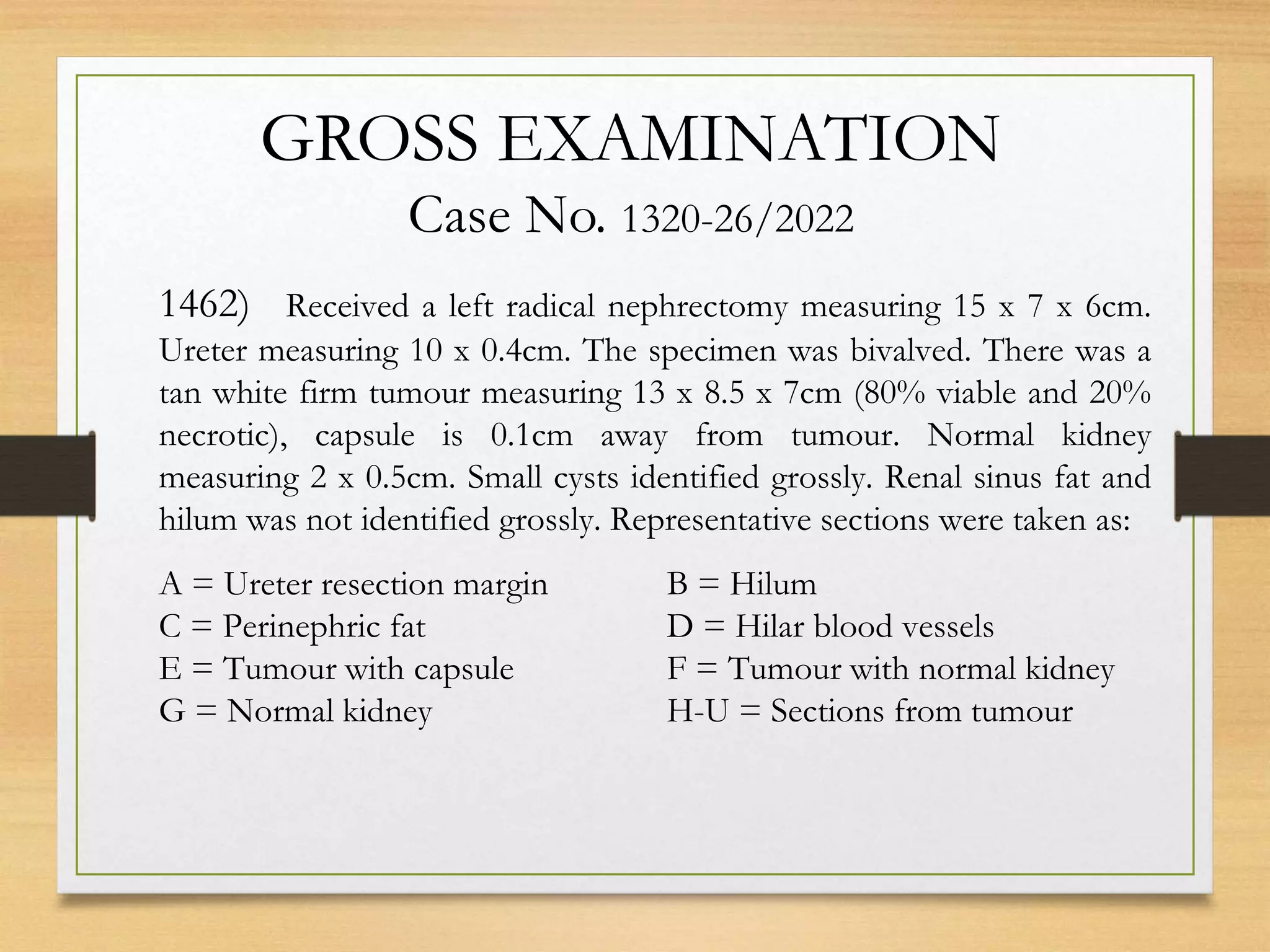 Wilms Tumor literature review and case presentation.pptx | Digestive ...