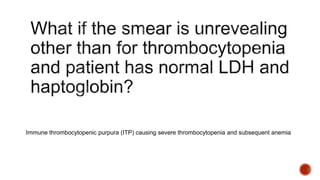 MAHA/TTP/DIC/HUS/aHUS | PPTX