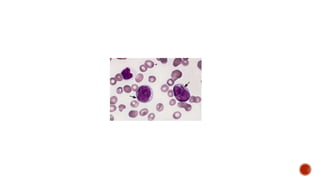 MAHA/TTP/DIC/HUS/aHUS | PPTX