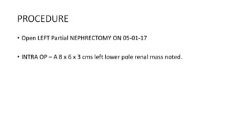 Cpc renal tumors | PPTX