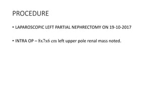 Cpc renal tumors | PPTX