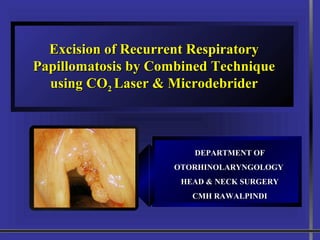 Respiratory Papillomatosis