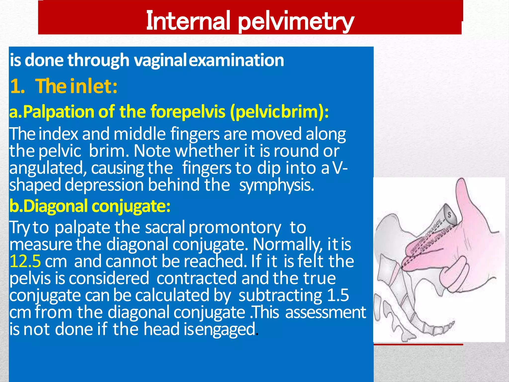 Cephalopelvic disproportion (CPD) & Contracted pelvis | PPTX