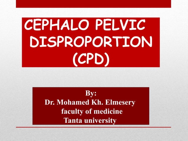 Cephalopelvic disproportion (CPD) & Contracted pelvis | PPTX ...